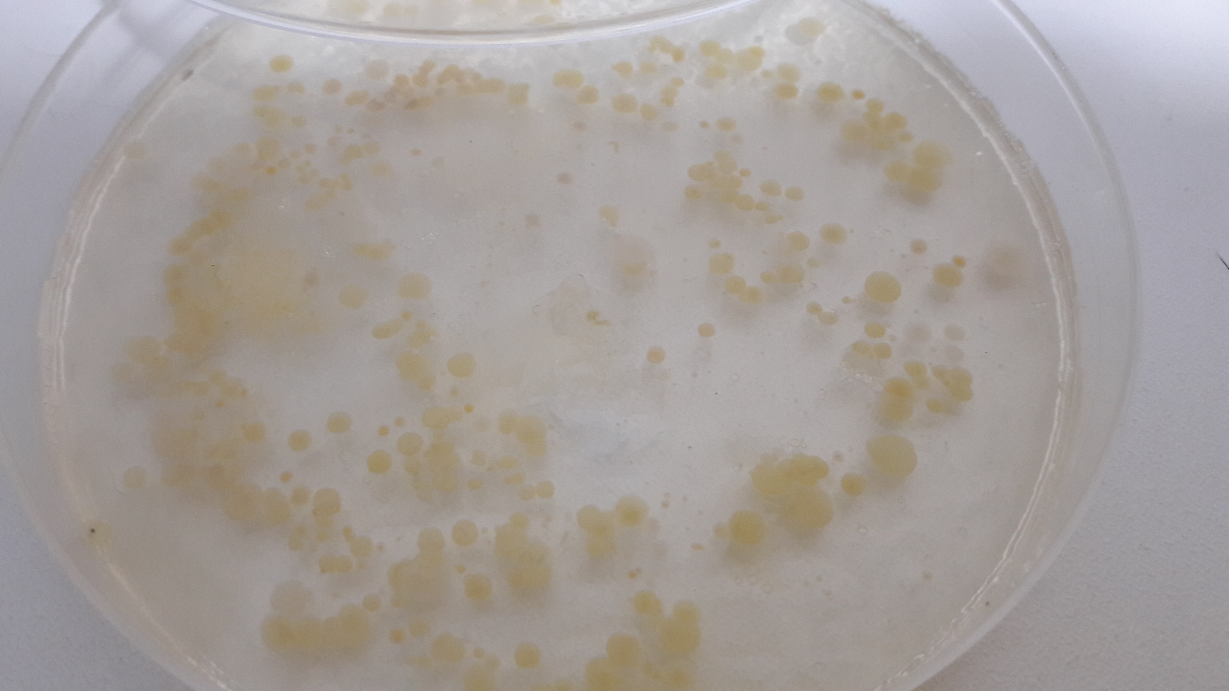 The Agar Test and Bacteria Culture – Danupon Drake